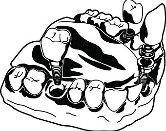 Dentures Drawing | Free download on ClipArtMag