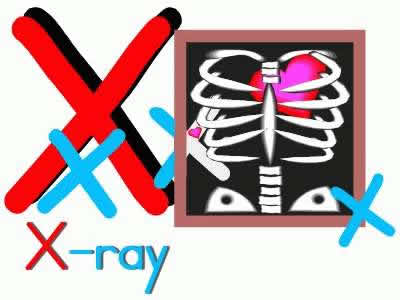 X Ray Drawing Kindergarten | Free download on ClipArtMag